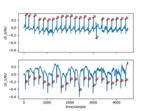 Python How Can I Make Certain Annotations Display In Wfdb Stack Overflow