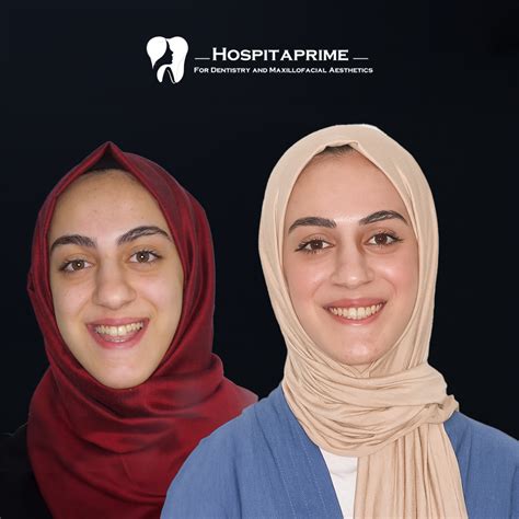 Before After Hospitaprime