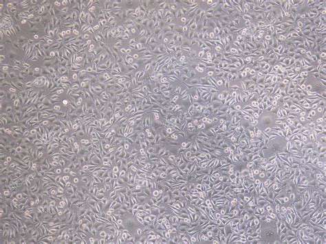 L 929 Cas9 Cell Line Ubigene