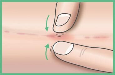 Cicatrice Après Opération Soins Essentiels Crèmes Massages