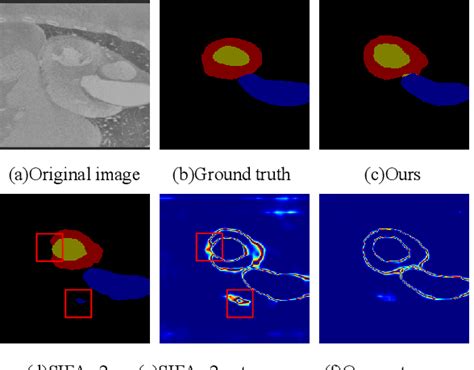 figure 1 from unsupervised domain adaptation for medical image segmentation by selective entropy