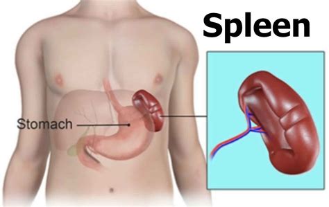 Splenectomy Indications Surgery Vaccines Diet Side Effects And Complications