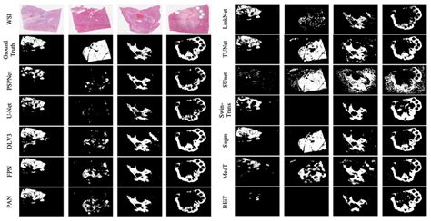 This Figure Presents The Qualitative Segmentation Results Using Download Scientific Diagram