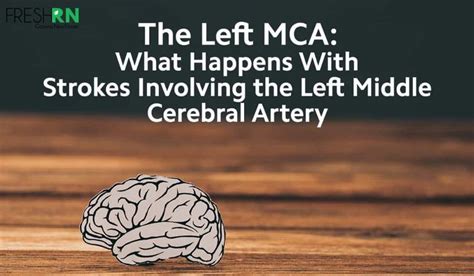 Left Mca Strokes What Happens With Strokes Involving The Left Middle