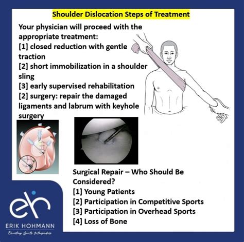 Shoulder Dislocation Steps Of Treatment Sports Injury Specialist In Dubai