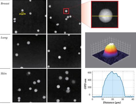 Reconstructed Phase Cancer Image A Cropped Single Cell With A Size Of Download Scientific