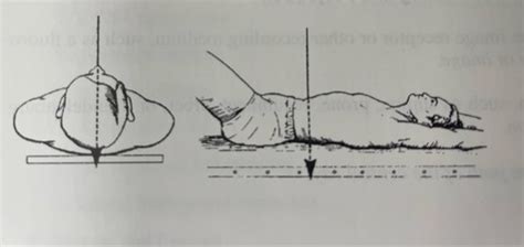 LIMITED XRAY EXAM Flashcards Quizlet