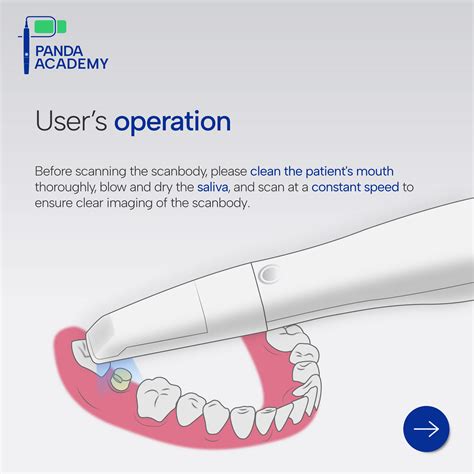 Panda Academy How To Scan The Scanbody