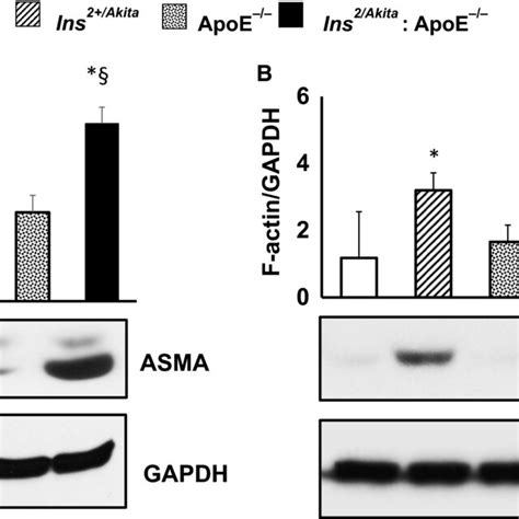 Expression Of Smooth Muscle α‐actin And F‐actin Western Analysis Of