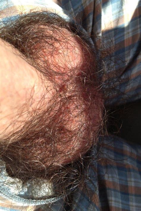Hairy Balls Runaniru Hairy Balls Runaniru