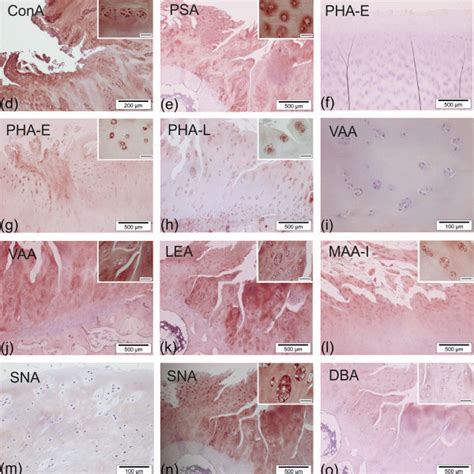 Lectin Histochemical Staining Profiles In Sections Of Oa Cartilage A Download Scientific