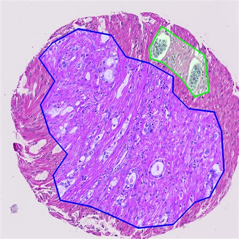 Weglenet A Weakly Supervised Convolutional Neural Network For The Semantic Segmentation Of