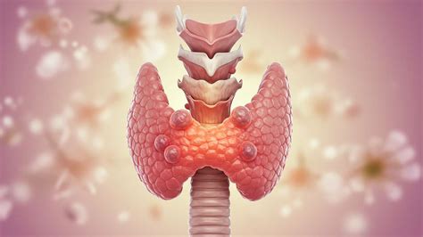 Thyroid Nodules Holistic Care In Montgomery County Maryland