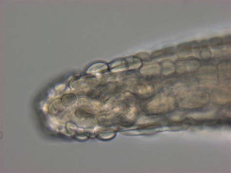 Its 3 Am Is That A Parasitic Worm In Your Cheek Op Ed Live Science