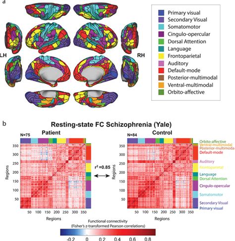 A Whole Brain And Cross Diagnostic Perspective On Functional Brain Network Dysfunction Pmc