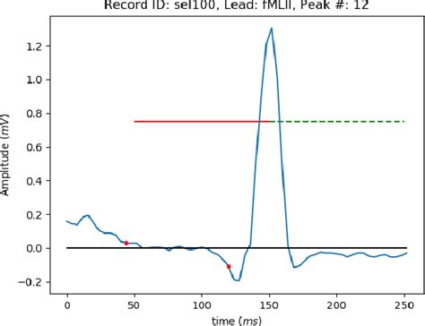 Figure 1 From Validation Of Baseline Wander Removal And Isoelectric Correction In