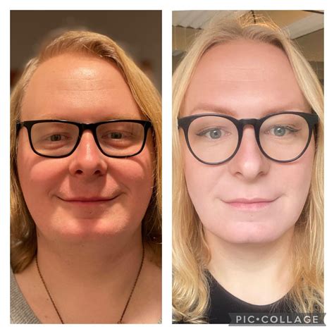 Face Timeline From 1 Year Of Hrt To Just About 2 Years Of Hrt R