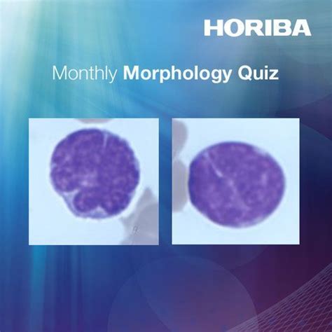 Cell Morphology Quiz Male Patient With Multiple Cells Horiba Uk