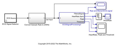 Real Time Ecg Qrs Detection Matlab And Simulink