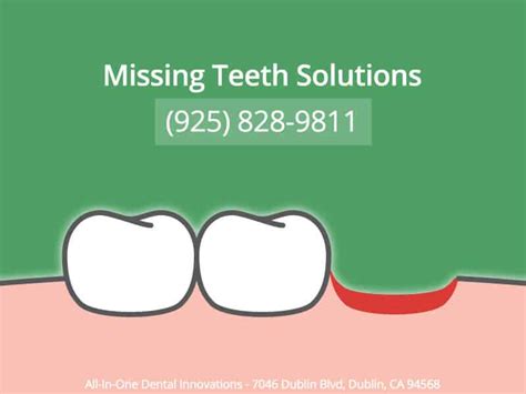 Missing Teeth Dublin Ca All In One Dental Innovations