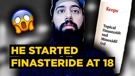 Man Tolerates Finasteride Use For 5 Years Before Side Effects Swarmed