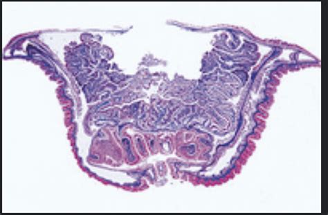 Solved Label As Many Parts For This Metridium Image