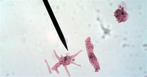 Biology Pictures Ameba Under Microscope