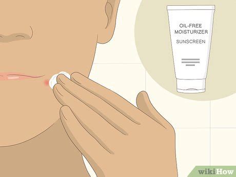 Ways To Get Rid Of Acne Redness Fast WikiHow Health Ways To Get Rid Of Acne Redness Fast WikiHow Health