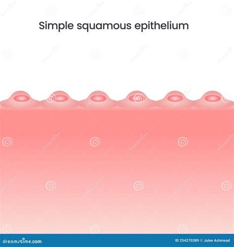 Squamous