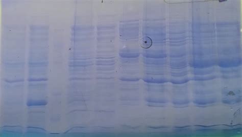 How To Avoid Non Specific Binding In Affinity Chromatography Ni Nta