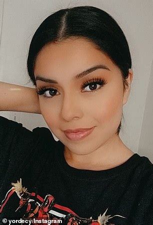 How To Get Rid Of A Pimple In Two Days Daily Mail Online