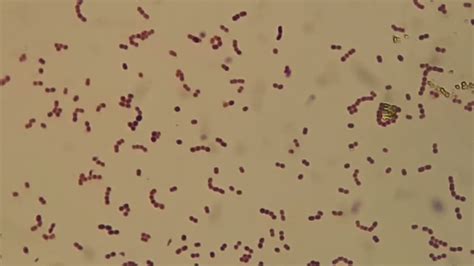 Gram Positive Cocci In Pairs