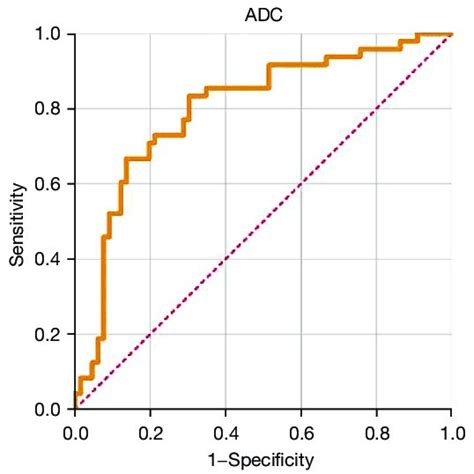 Roc Curve By Adc Values Roc Receiver Operating Characteristic Adc