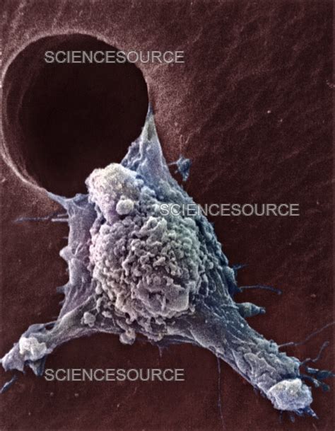 Migrating Cancer Cell Sem Stock Image Science Source Images