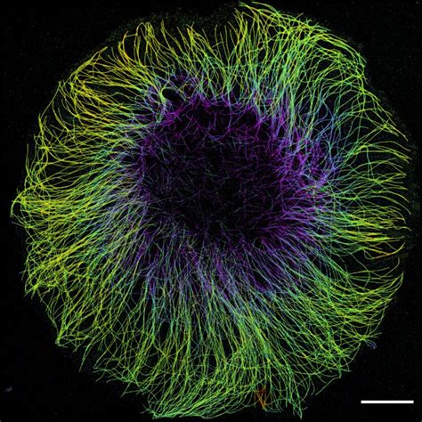 France Bioimaging On Linkedin Microscopy Research Bioimaging Lifescience