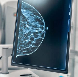 Algoritmo de diagnóstico Todos os fabricantes de equipamentos médicos