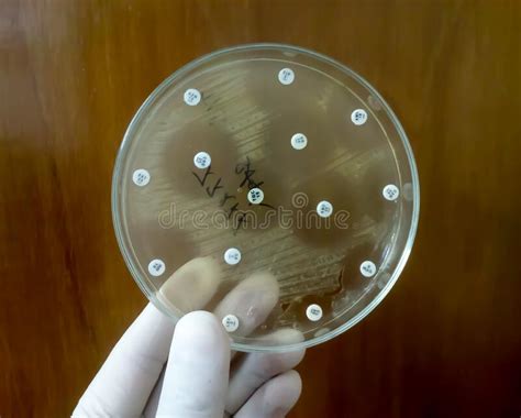 Antimicrobial Susceptibility Testing Stock Image Image Of Laboratory