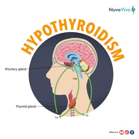 What Is Hypothyroidism Nuvovivo Reverse Your Age And Lifestyle Diseases