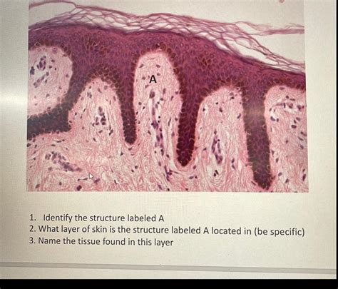 [answered] a 1 identify the structure labeled a 2 what layer of skin is