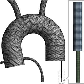 Finite Element Meshing Model The Right Graphic Is The Partial Enlarged Download Scientific