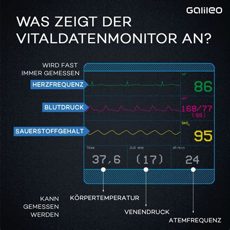 Intensivstation: Aufbau und warum Intensivbetten gerade so wichtig sind ...