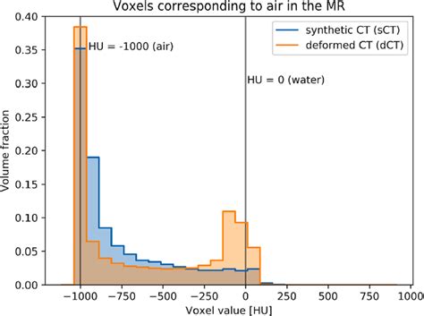 Distribution Of The Voxel Values In Sct And Dct With The Air Contour Download Scientific