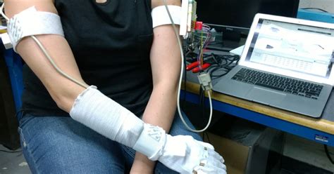 Low Cost Technology May Improve Rehab For Stroke Victims Health Data Management