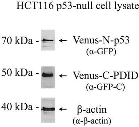 Bimolecular Fluorescence Complementation Bifc Assay For Direct Visualization Of Protein
