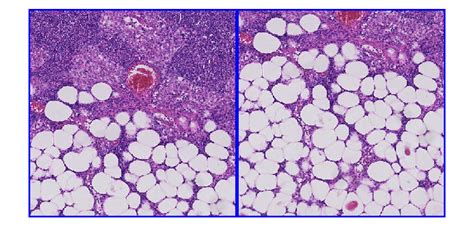 Bigimagedatastore To Be Removed Datastore To Manage Blocks Of