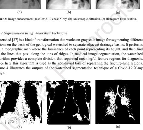 Outcomes Of Watershed Segmentation Technique A Segmented Lung B Download Scientific