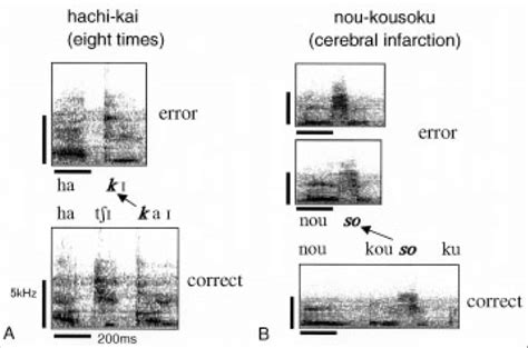 Examples Of Sequential Errors Pre Positioning A Consonant K Of