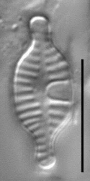 Compare Planothidium Rostratoholarcticum Species Diatoms Of North