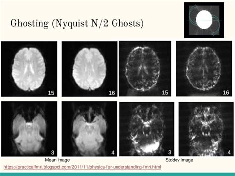 Quality Control For Structural And Functional Mri