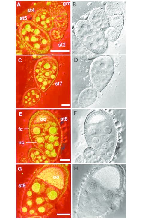 Grau Gfp Localization During Oogenesis Ovaries Were Isolated From